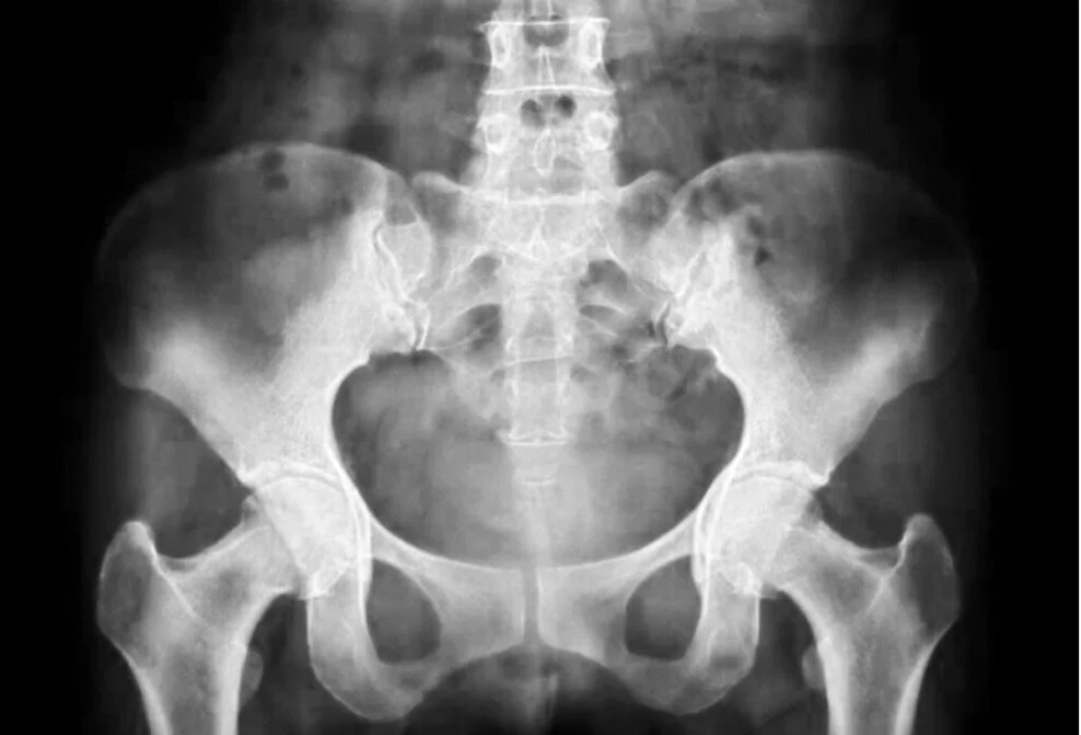 Pelvic Health Following Gender Confirmation Surgery. — DR Z PHD