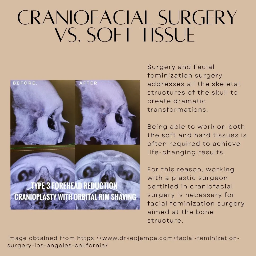 Trans Feminine: The Ultimate Guide to Gender Transition! — DR Z PHD