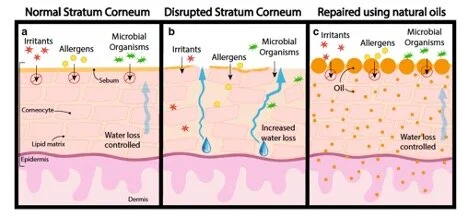 The Skin Barrier Trifecta - Ceramides, Cholesterol and Fatty Acids by ...