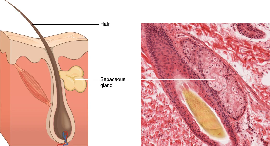 Bumpy Skin, Sebaceous Hyperplasia and Electrocautery by Deborah Tosline ...