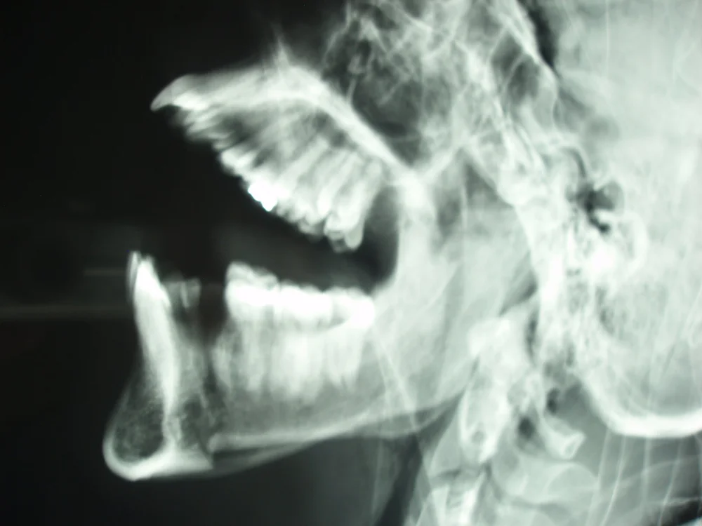 Facial Architecture, Bone Volume, and Aging by Deborah Tosline — Skin ...