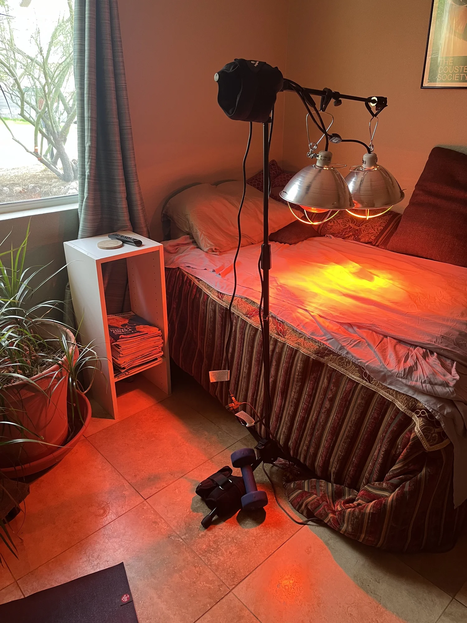 Complete Proximal Hamstring Avulsion and Surgical Reattachment of ...