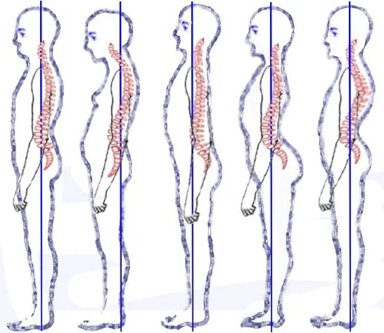 My Anecdotal Experience – Posture by Deborah Tosline — Skin Remodeling DIY