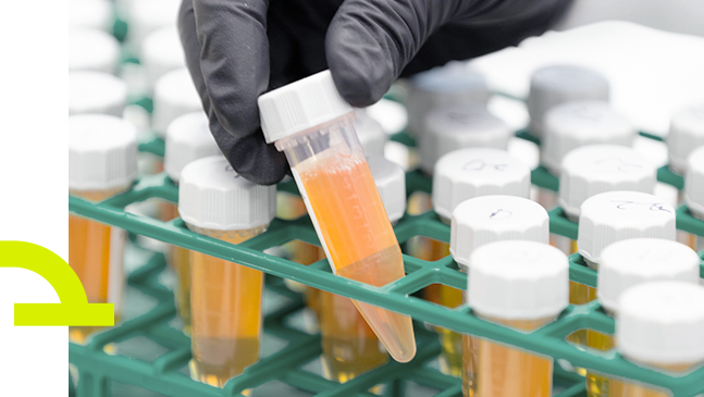 Freenome | Early Cancer Detection Company