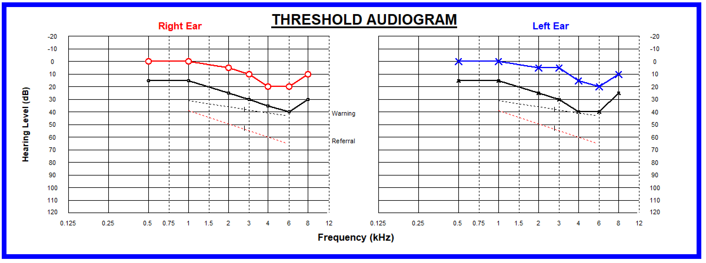 Repeat Testing Frequency For Screening Audiometry The Noise Chap repeat-testing-frequency-for-screening-audiometry-the-noise-chap