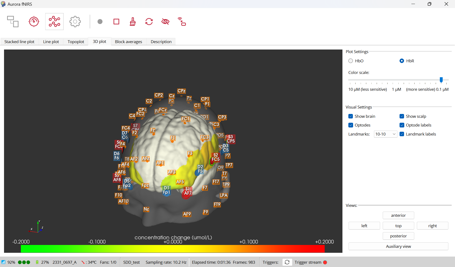 NIRSport2 | fNIRS Systems | NIRS Devices | NIRx