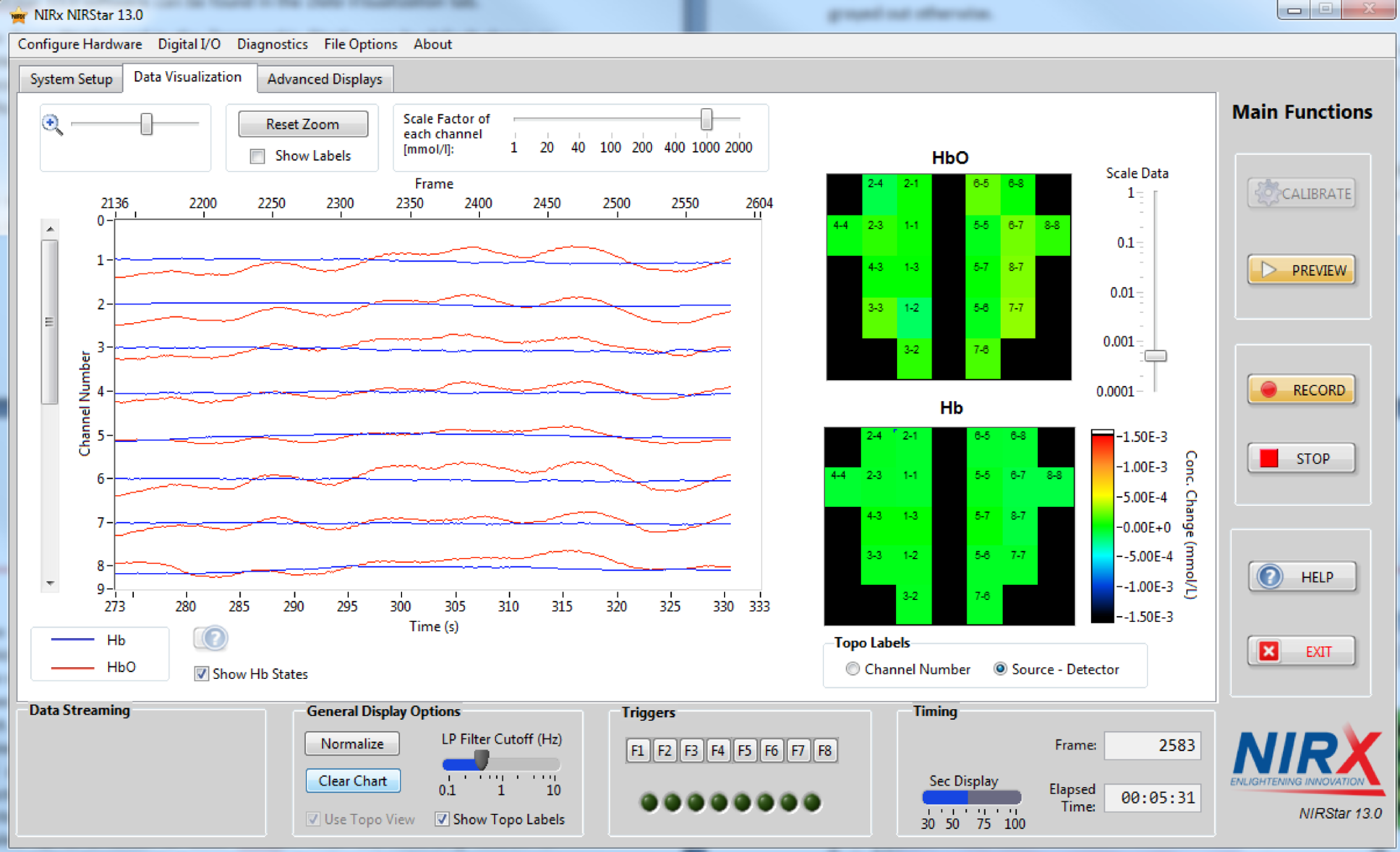 fNIRS Software: NIRS Analysis | NIRS Data Recording | fNIRS Systems | NIRS Devices | NIRx
