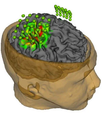 fNIRS Software: NIRS Analysis | NIRS Data Recording | fNIRS Systems ...