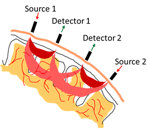 Our Story | fNIRS Systems | NIRS Devices | NIRx
