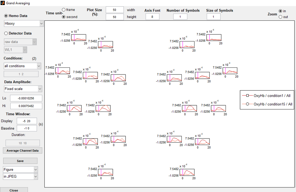 fNIRS Analysis | NIRS Analysis Techniques, Homer2, NIRS Toolbox, NIRS ...