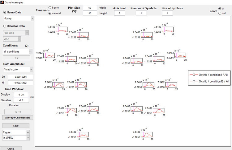 fNIRS Analysis | NIRS Analysis Techniques, Homer2, NIRS Toolbox, NIRS ...