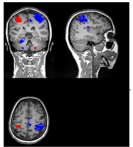 fNIRS - fMRI | Concurrent NIRS MRI Recording Measurements & Experiments ...