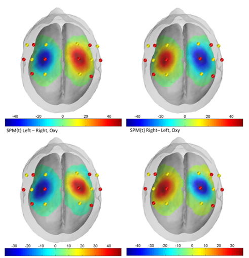 fNIRS - fMRI | Concurrent NIRS MRI Recording Measurements & Experiments ...