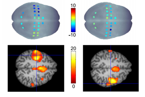 fNIRS - fMRI | Concurrent NIRS MRI Recording Measurements & Experiments ...
