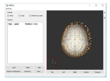Platform Updates & Extensions | fNIRS Systems | NIRS Devices | NIRx
