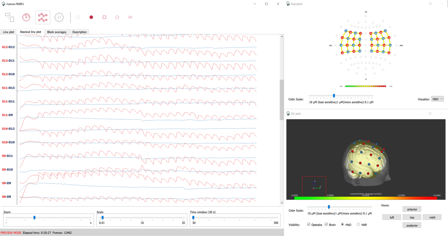 fNIRS Software: NIRS Analysis | NIRS Data Recording | fNIRS Systems ...