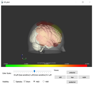 NIRSport2 | fNIRS Systems | NIRS Devices | NIRx
