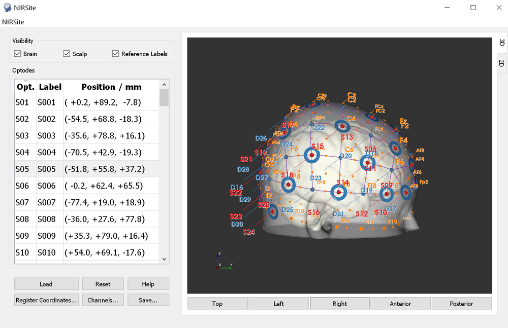 NIRSite 2.0 | NIRx | fNIRS Systems | NIRS Devices