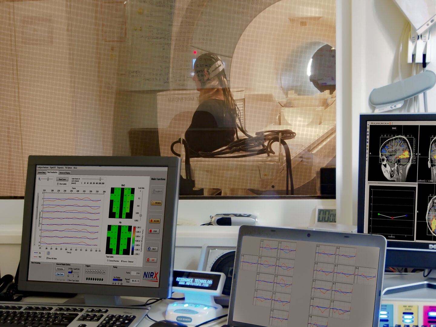 fNIRS - fMRI | Concurrent NIRS MRI Recording Measurements & Experiments | fNIRS Systems | NIRS ...