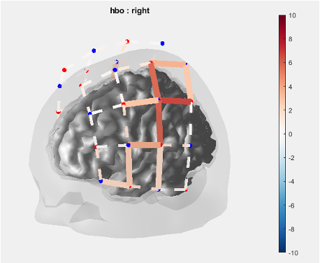 NIRx File Formats | fNIRS Systems | NIRS Devices | NIRx