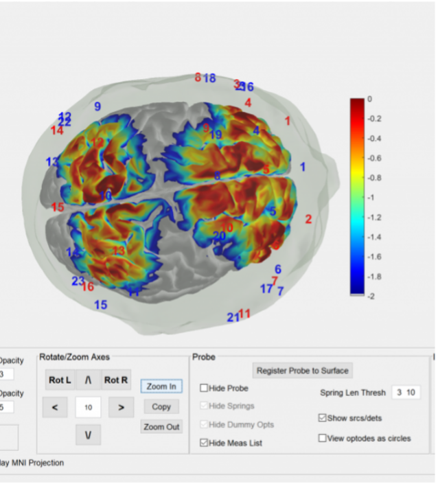 NIRx File Formats | fNIRS Systems | NIRS Devices | NIRx