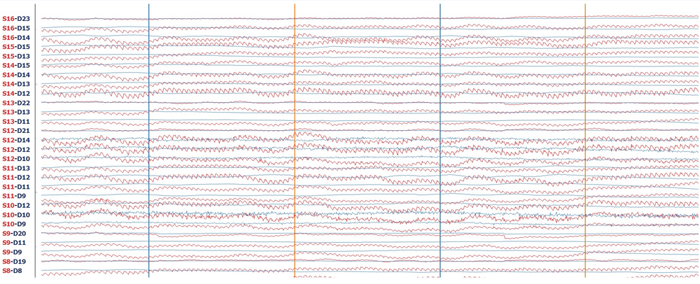 fNIRS Software: NIRS Analysis | NIRS Data Recording | fNIRS Systems ...