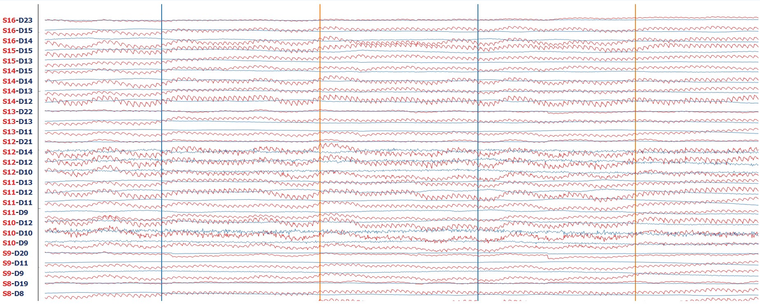 fNIRS Software: NIRS Analysis | NIRS Data Recording | fNIRS Systems ...