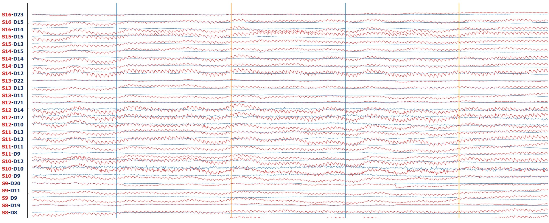 fNIRS Software: NIRS Analysis | NIRS Data Recording | fNIRS Systems ...