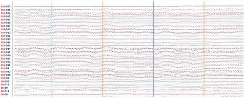 fNIRS Software: NIRS Analysis | NIRS Data Recording | fNIRS Systems ...