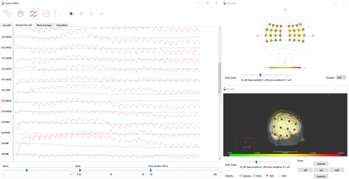 fNIRS Software: NIRS Analysis | NIRS Data Recording | fNIRS Systems ...