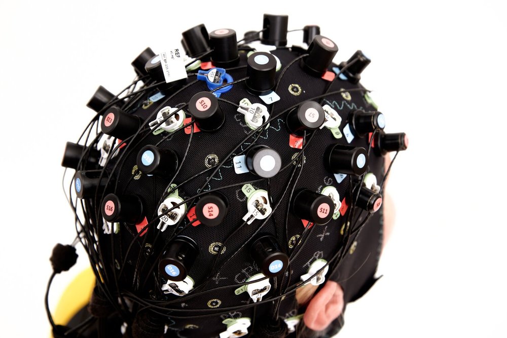 fNIRS - EEG | fNIRS Systems | NIRS Devices | NIRx