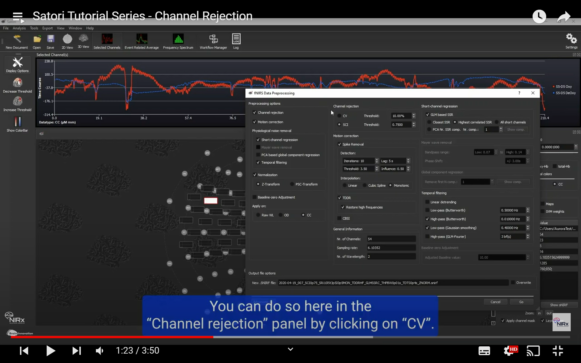 Satori — Blog-content | fNIRS Systems | NIRS Devices | NIRx
