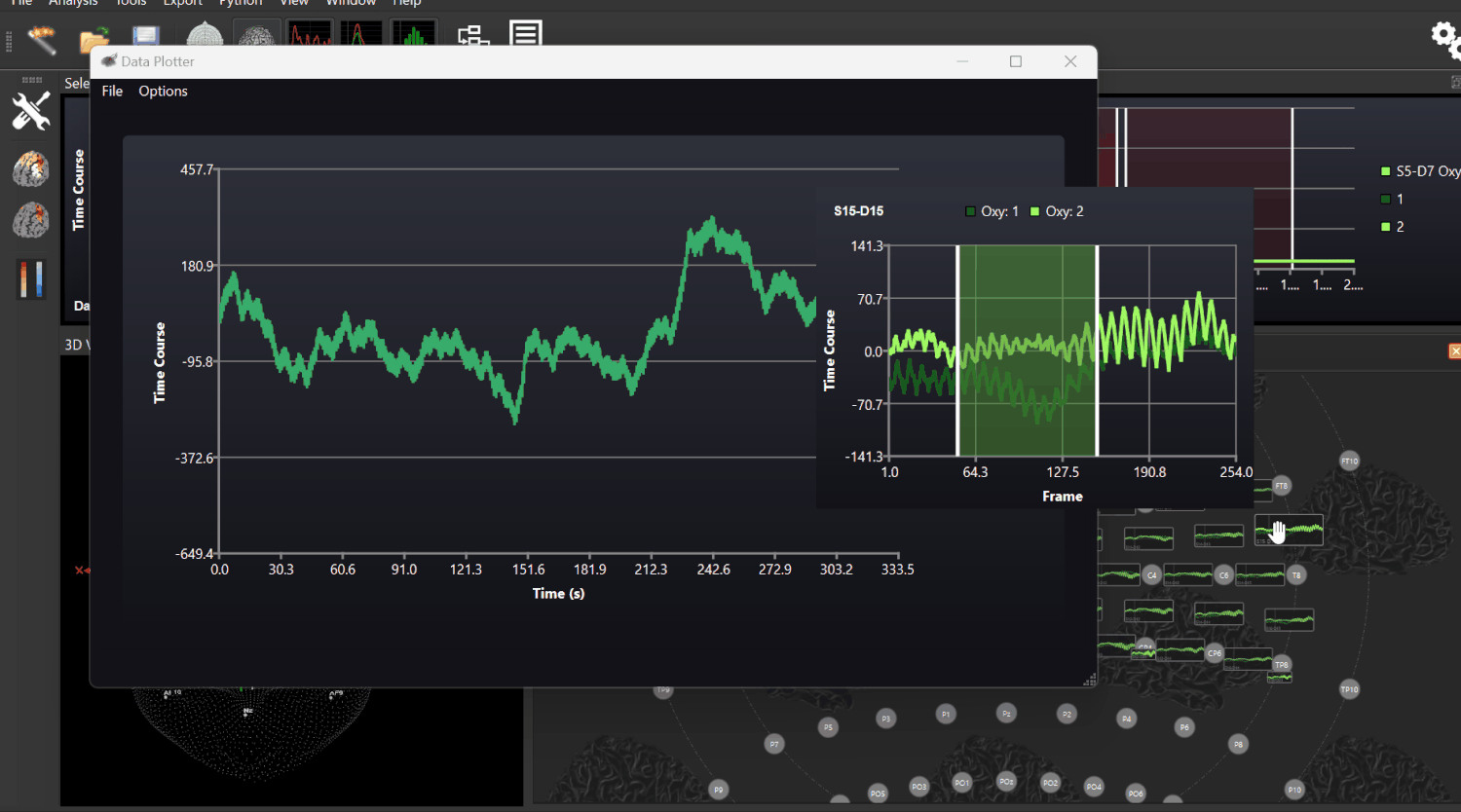 Blog-content | fNIRS Systems | NIRS Devices | NIRx