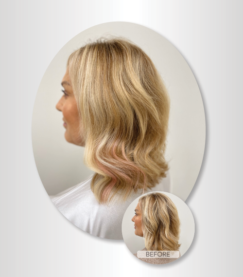 Platinum Seamless-The V-Light Extension System