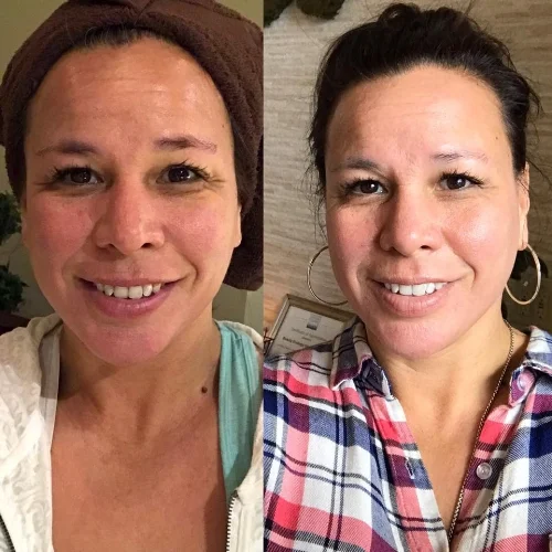 Bio Lift + Real Results with Natalie (photo to prove it inside ...