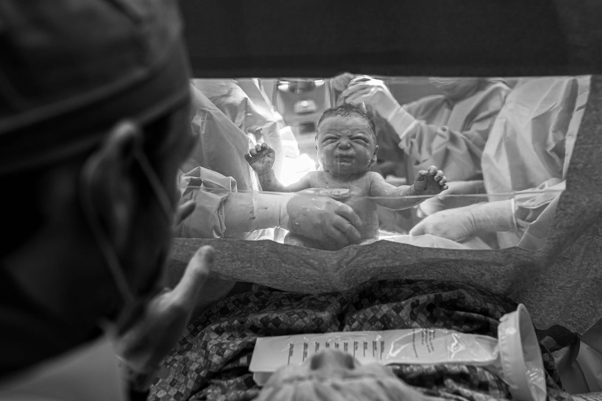 Cesarean — Birth Becomes You - Resources and Courses for New Birth ...