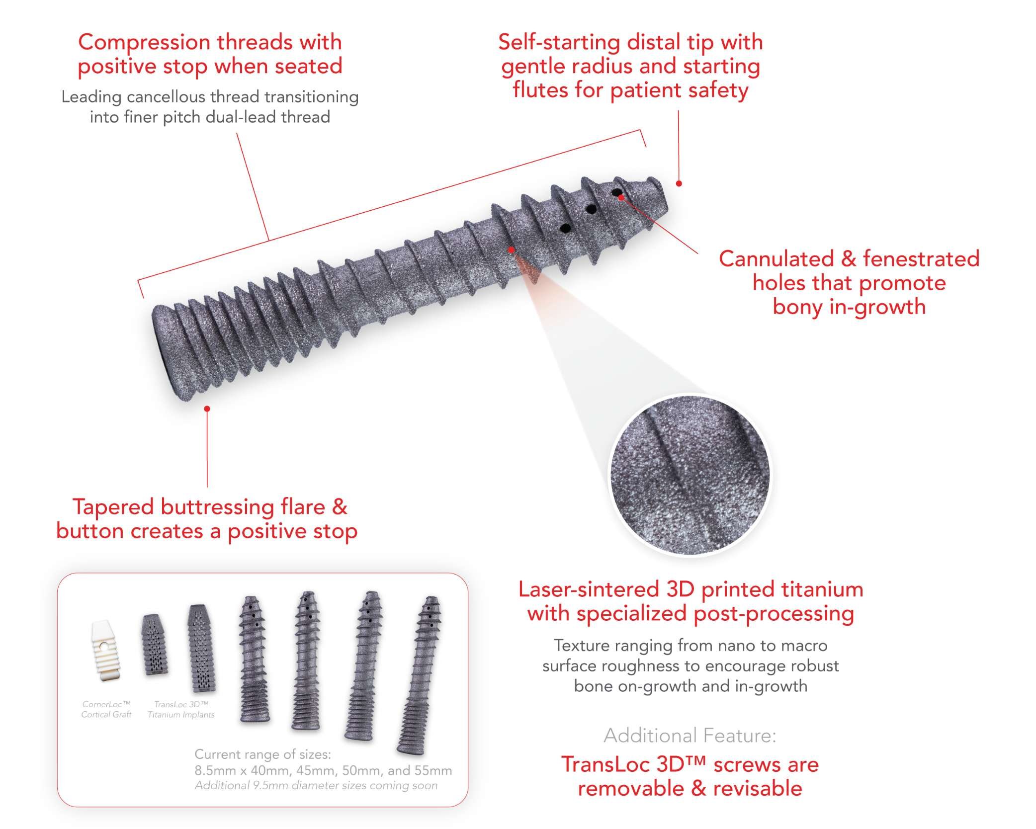 TransLoc 3D™ SI Joint Fusion System — Advanced Diagnostic Pain ...