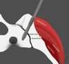 TransLoc 3D™ SI Joint Fusion System — Advanced Diagnostic Pain ...