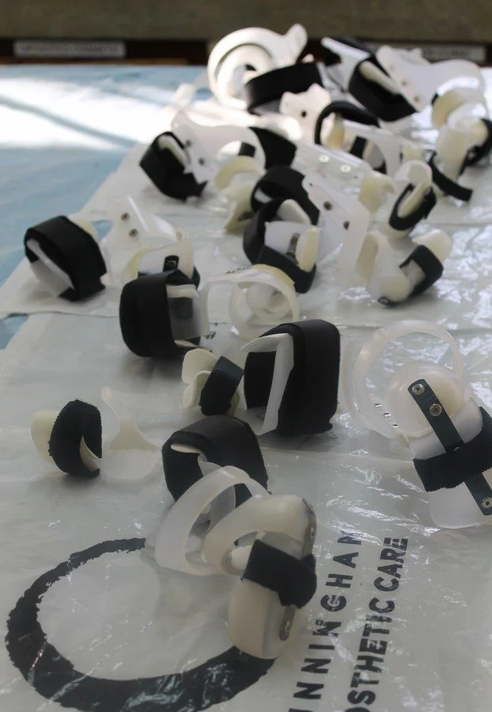 Clubfoot Bracing — Cunningham Prosthetic Care