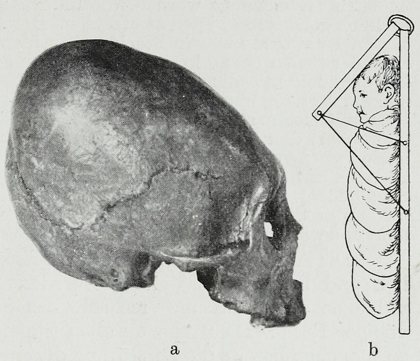 The Mystery of Peru's Elongated Skulls – Science vs Myth — Louis Wolf