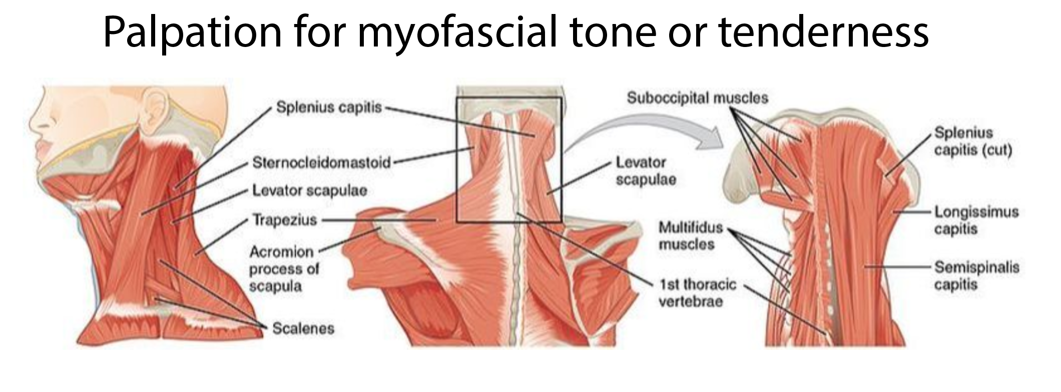 Copy of CONCUSSION SCREENING EXAMS — Resolution Physiotherapy & IMS Clinic