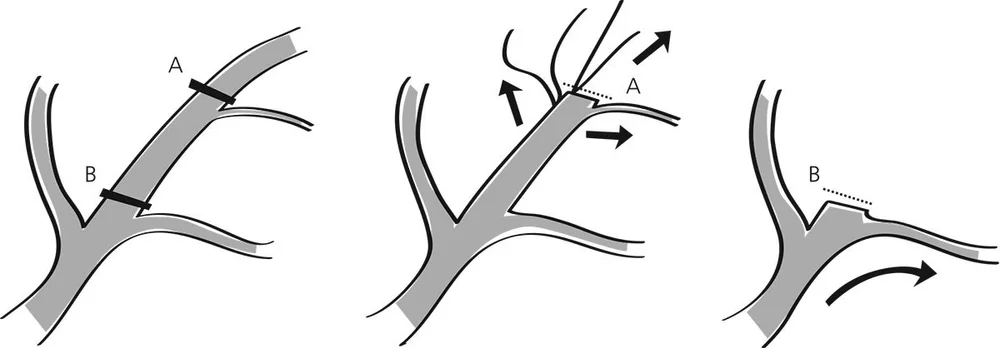 Pruning Ornamental Trees — Seattle's Favorite Garden Store Since 1924 ...