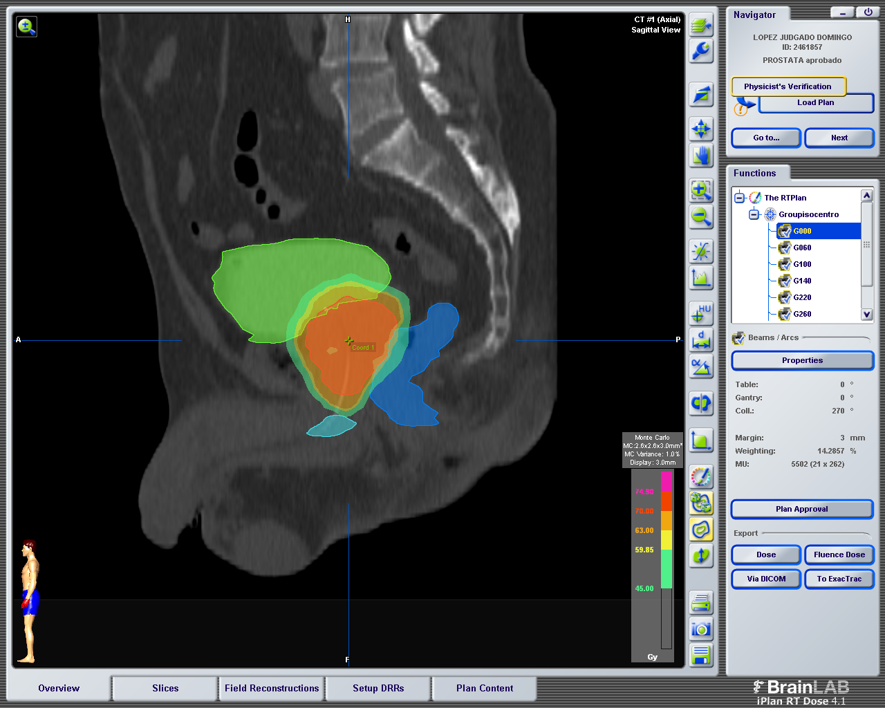 IMRT-VMAT — Radioterapia HM