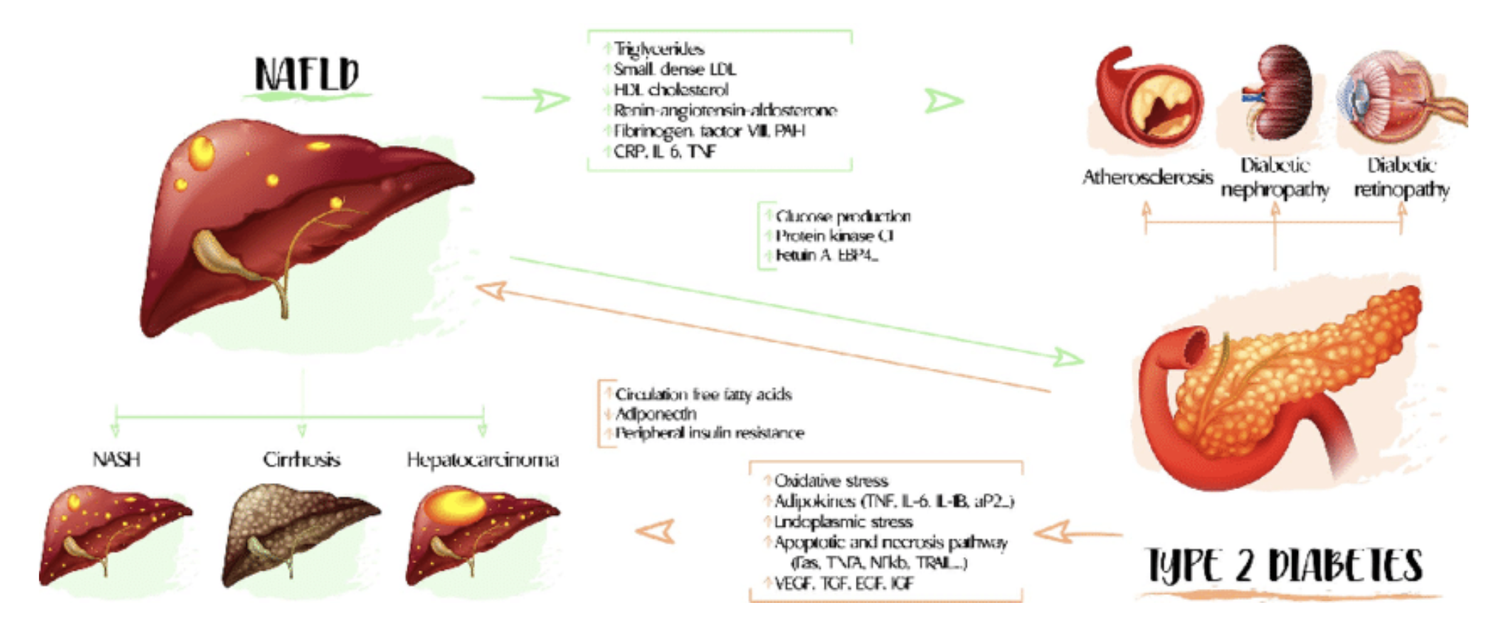 What Every Pharmacist Needs to Know about Non-Alcoholic Fatty Liver ...