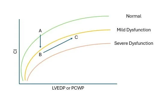 Heart Failure: Signs and Symptoms — tl;dr pharmacy