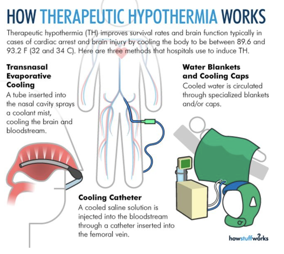 Therapeutic Hypothermia Rewarming After Therapeutic Hypothermia Rewarming After