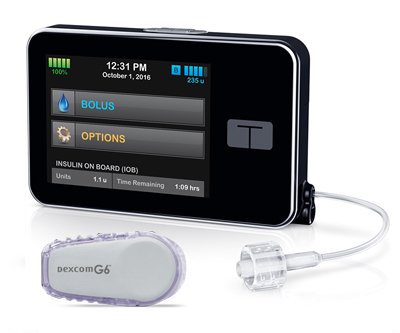 Continuous Glucose Monitors and Insulin Pumps: A Guide for Pharmacists ...