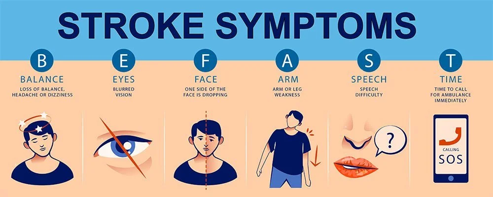 The Pharmacist's Quick Guide to tPA for Acute Ischemic Strokes — tl;dr ...