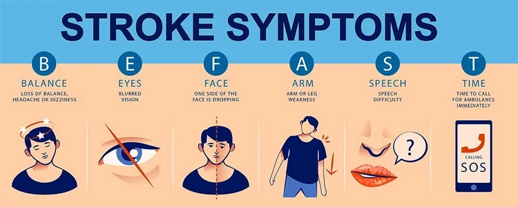 The Pharmacist's Quick Guide to tPA for Acute Ischemic Strokes — tl;dr ...