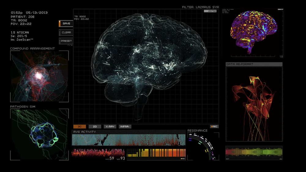 The Lazarus Effect — brandon parvini